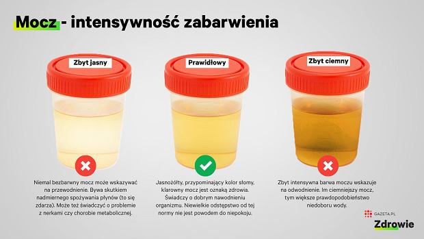 Jaki kolor moczu jest Niepokojacy? - Fundacja dla kociąt osieroconych ...